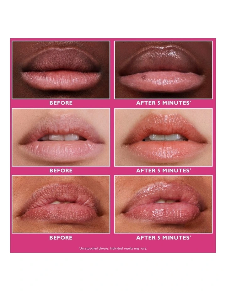 Peter Thomas Roth Instant Firmx Lip Filler 10ml | MYER